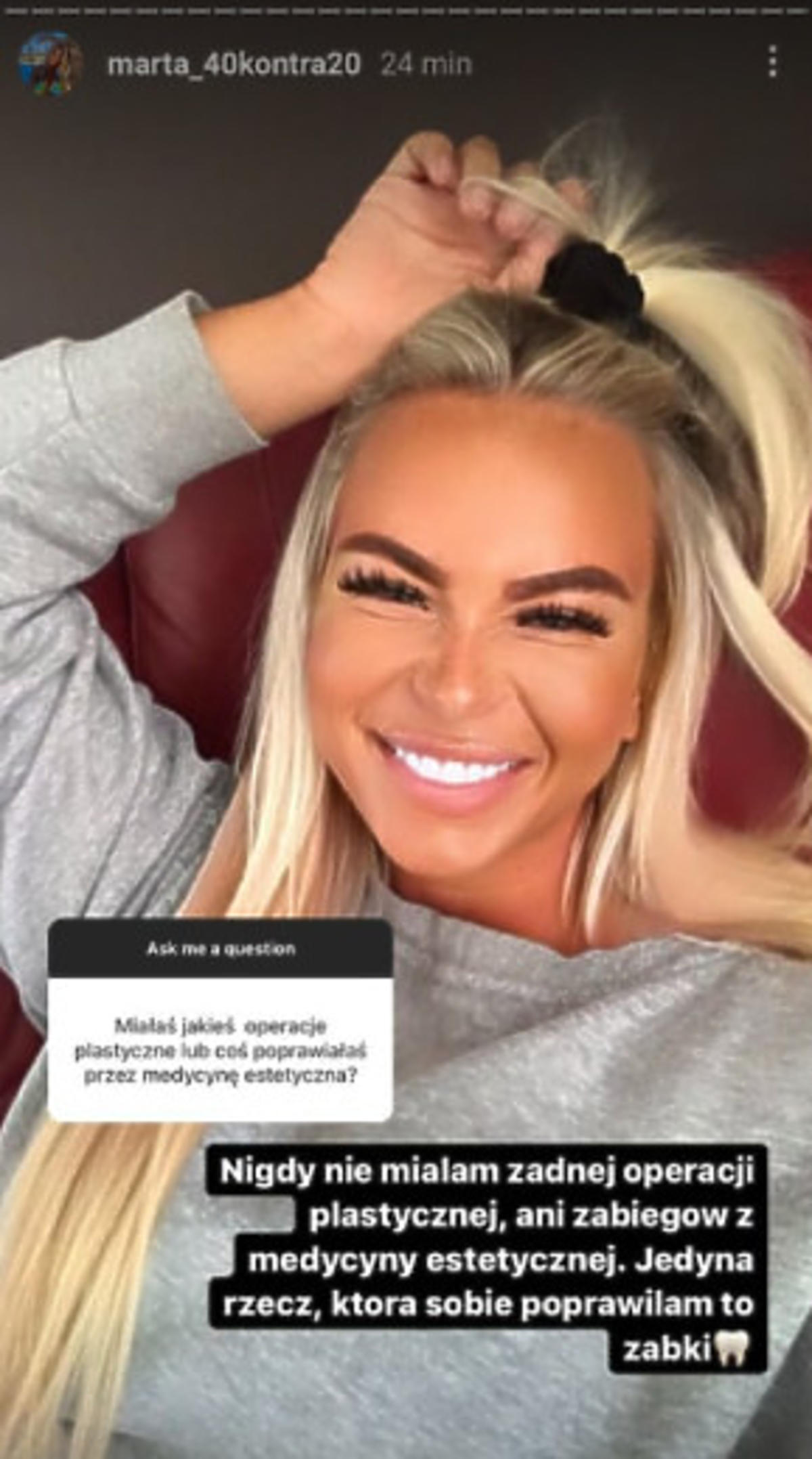 "40 kontra 20": Marta eksperymentuje z twarzą! Zdecydowała się na ...