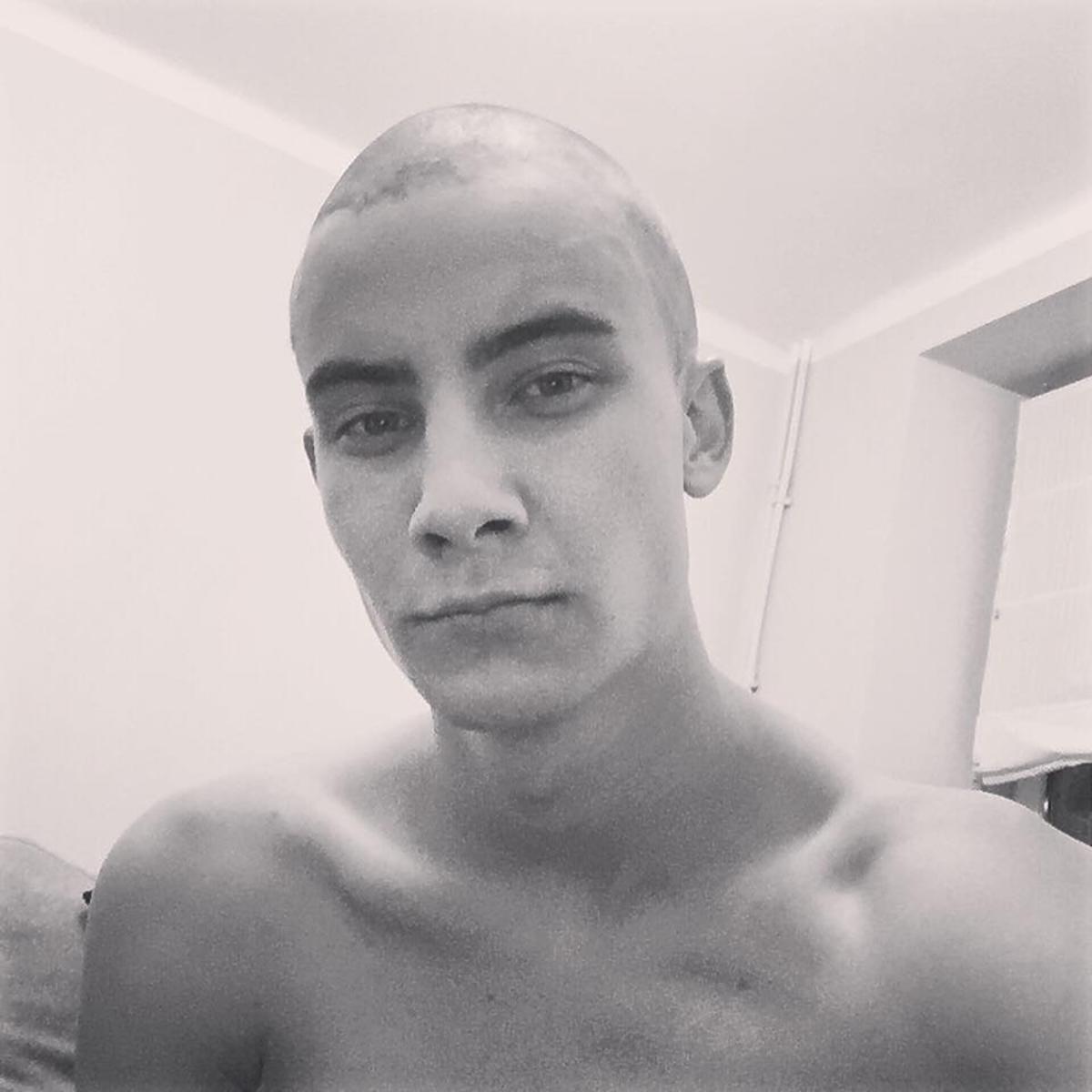 Adam Boguta z Top model ma pękniętą czaszkę. Co się stało?