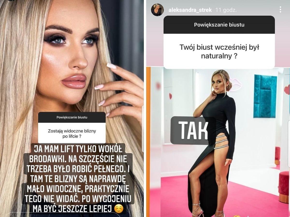 "Love Island": Aleksandra poprawiła piersi, a fani komentują: "Twój ...