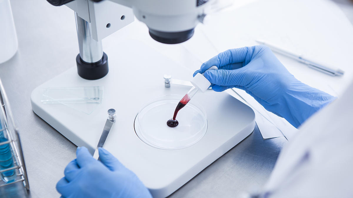 Badanie FT4: norma, co oznacza podwyższone lub obniżone stężenie