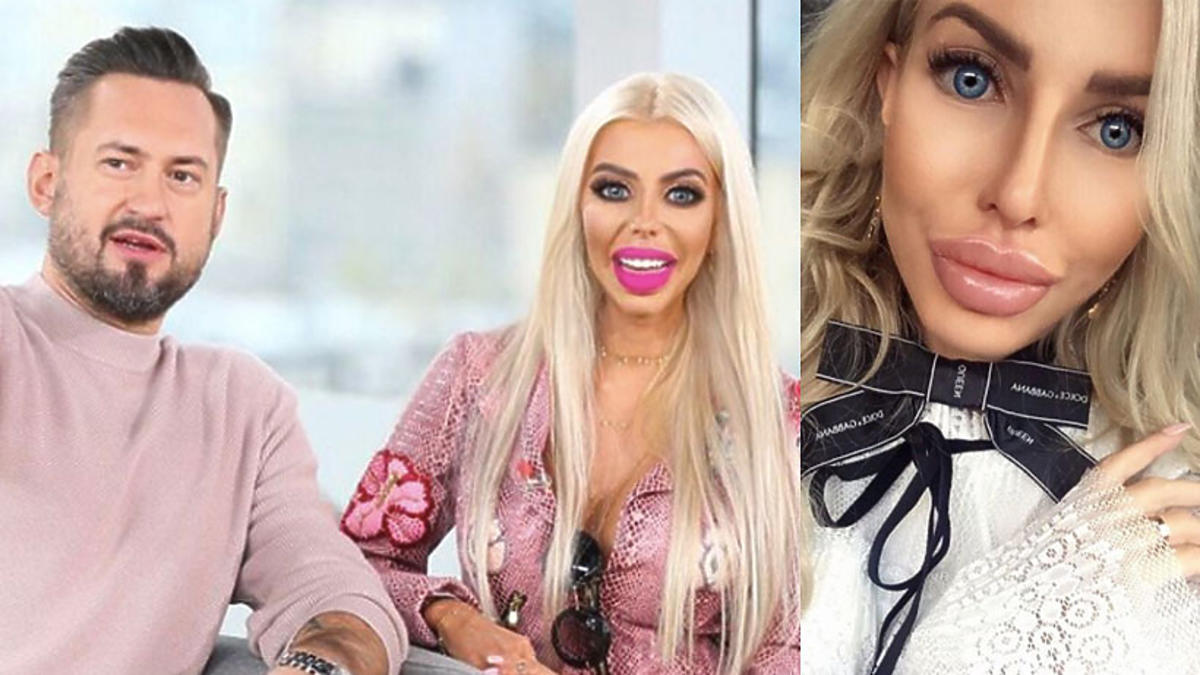 Anella wyłączyła komentarze na Instagramie Dlaczego? Komentarz