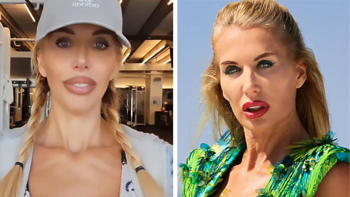 "Żony Miami": Aneta Glam pokazała się bez makijażu i przed operacjami ...