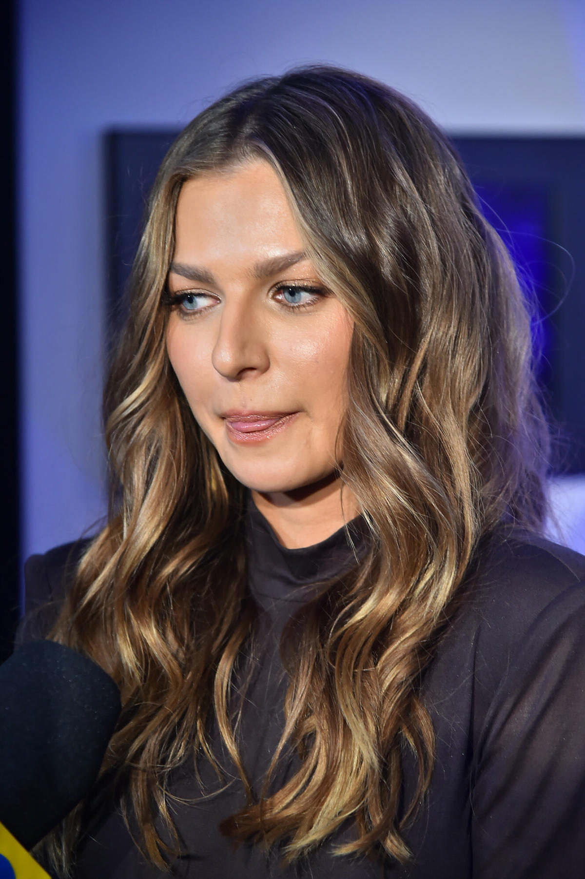 Anna Lewandowska poprawiła sobie policzki? "Męczę się z tym okropnie"