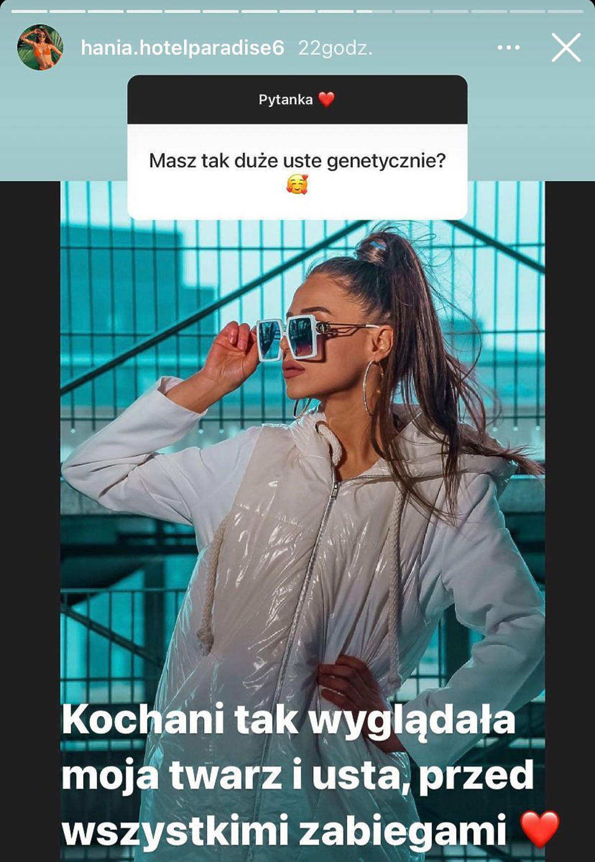 "Hotel Paradise": Hania pokazała, jak wyglądała zanim zrobiła sobie usta