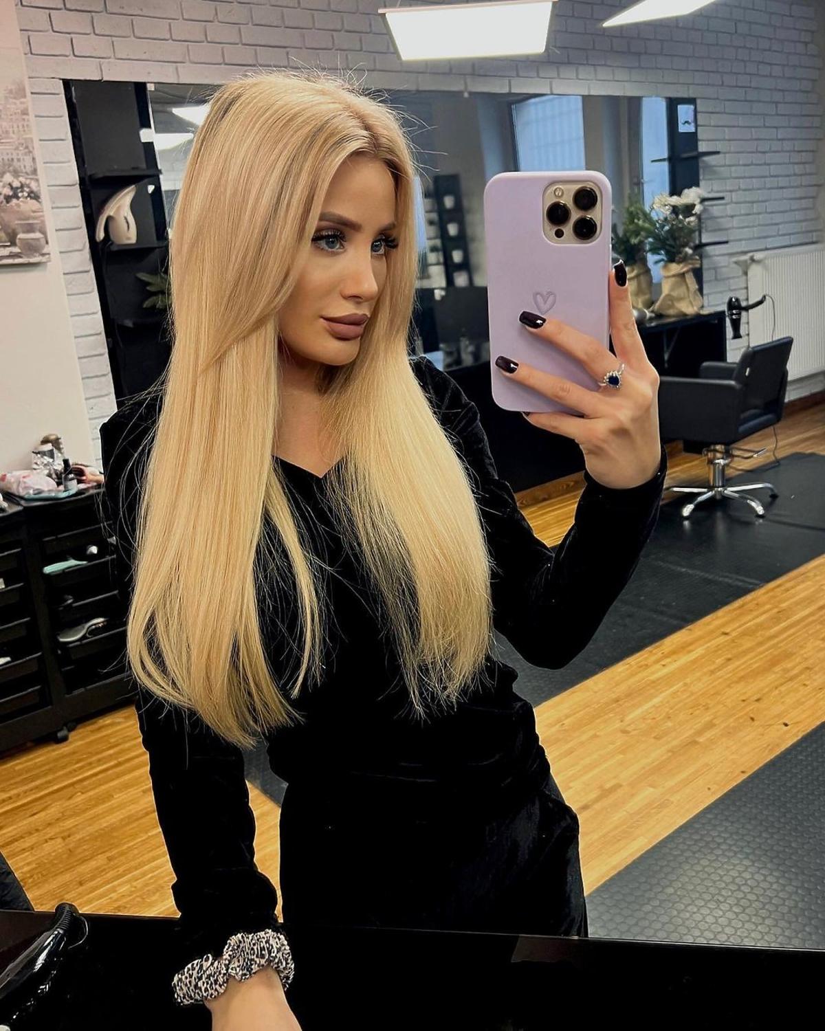 "Hotel Paradise": Ania Adamczyk przeszła totalną metamorfozę. Nowy nos ...