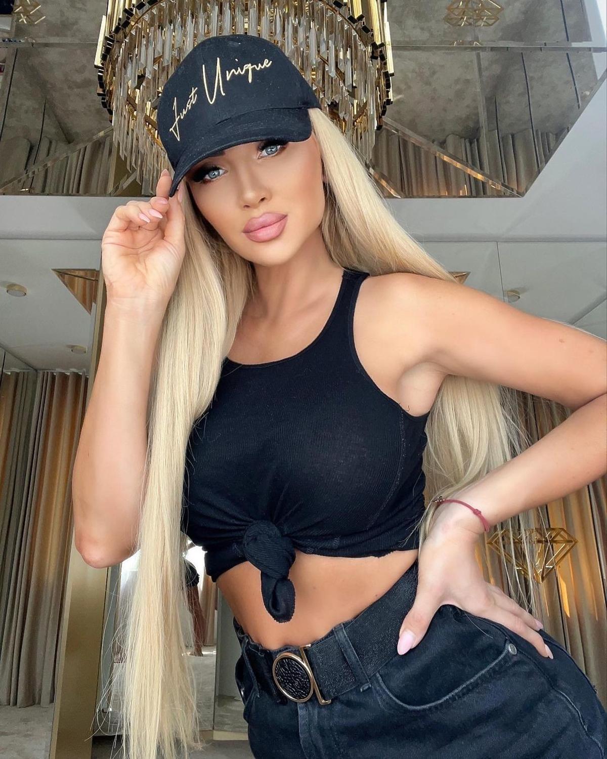 "Królowe życia": Izabela Macudzińska szczerze o drugiej operacji nosa. "Nos zaczął mi się zapadać"